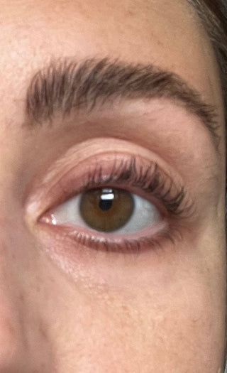 Before & After Photos – UKLASH
