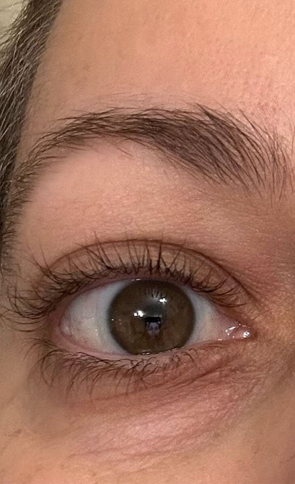 Before & After Photos – UKLASH