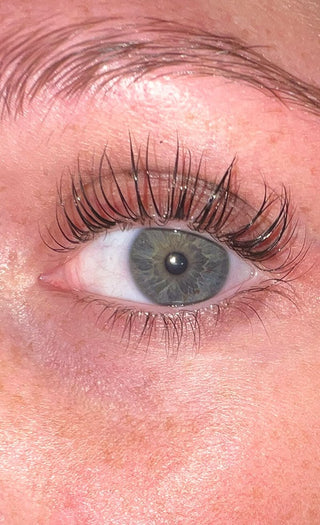 Before & After Photos – UKLASH