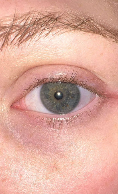 Before & After Photos – UKLASH