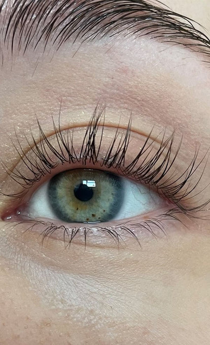 Before & After Photos – UKLASH