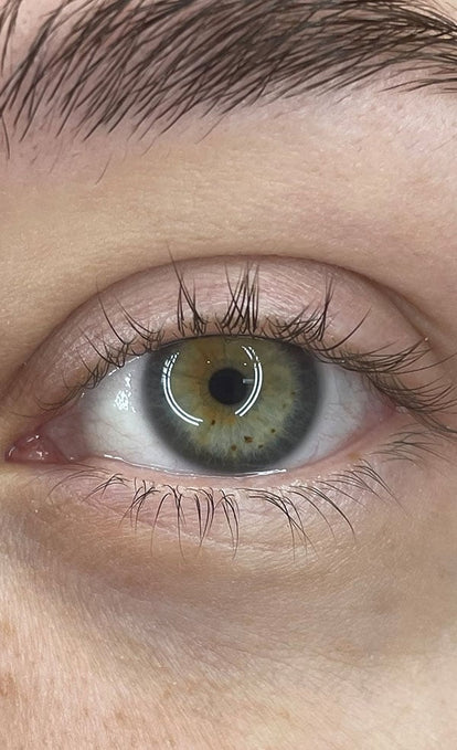 Before & After Photos – UKLASH