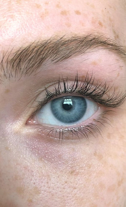 Before & After Photos – UKLASH