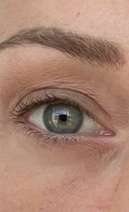 Before & After Photos – UKLASH