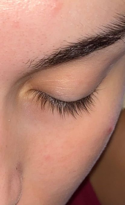Before & After Photos – UKLASH