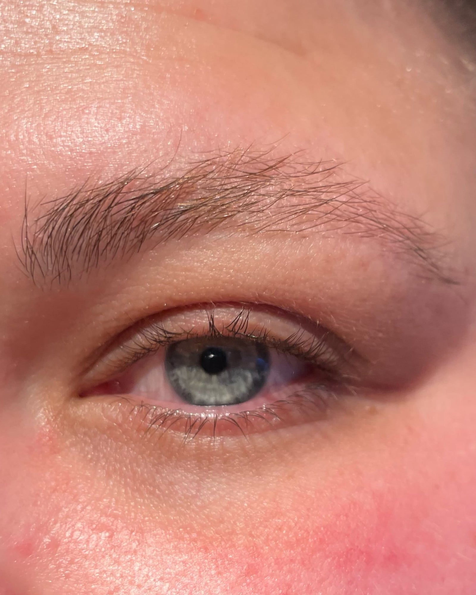Before & After Photos – UKLASH