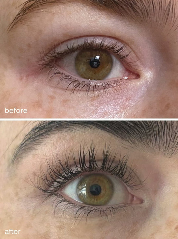 UKLASH Eyelash Growth Serum | Lash Serum, Longer Lashes | 10% Off