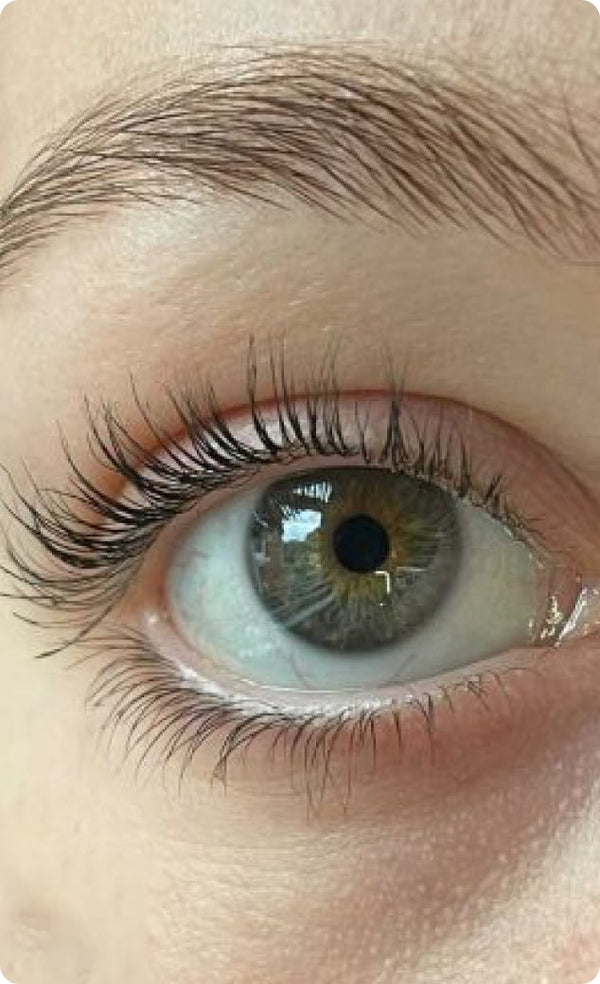 Before & After Photos – UKLASH