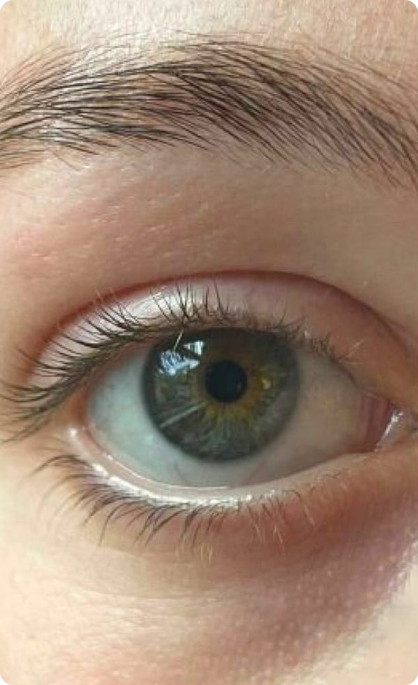 Before & After Photos – UKLASH